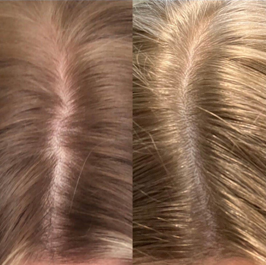 Najeau Follicle Drops