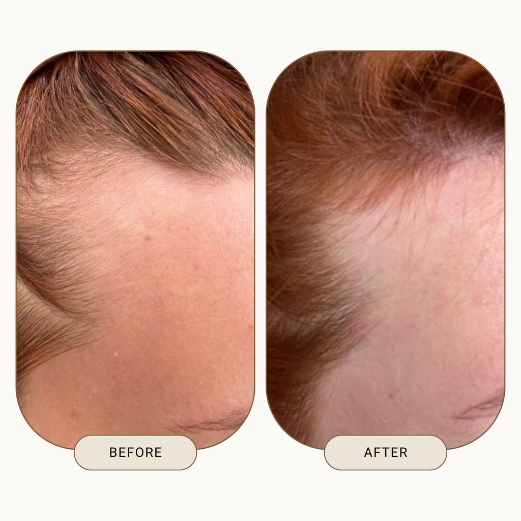 Najeau Follicle Drops