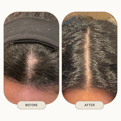 Najeau Follicle Drops